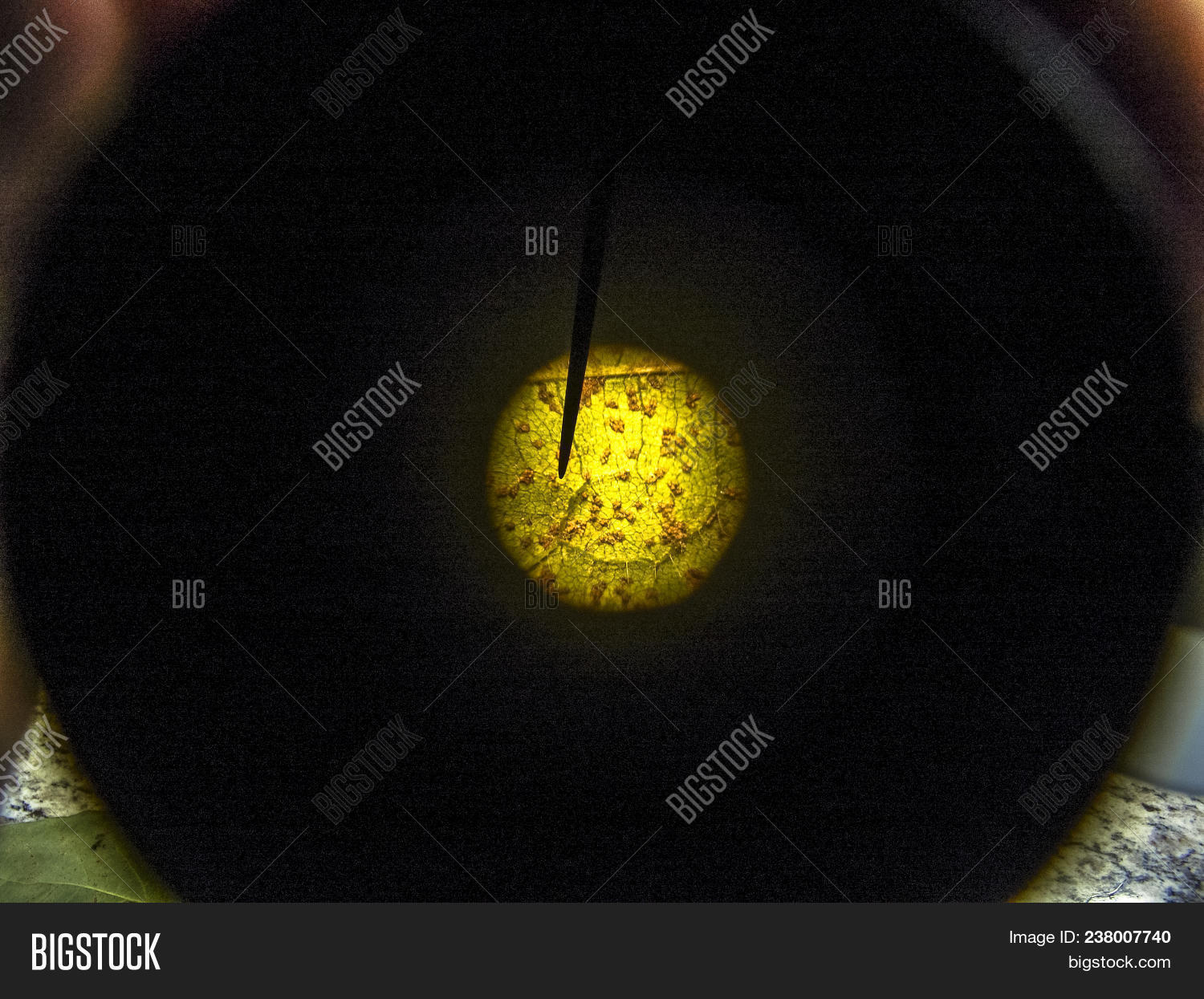 Asian Rust (phakopsora Image & Photo (Free Trial) | Bigstock