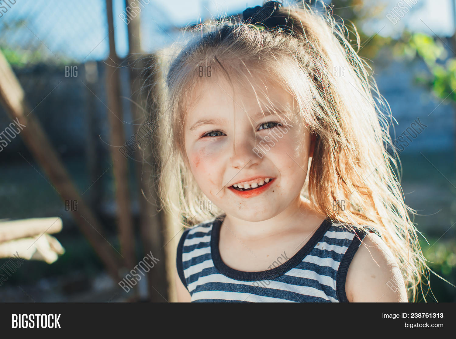 Girl Bruised Bruised Image & Photo (Free Trial) | Bigstock