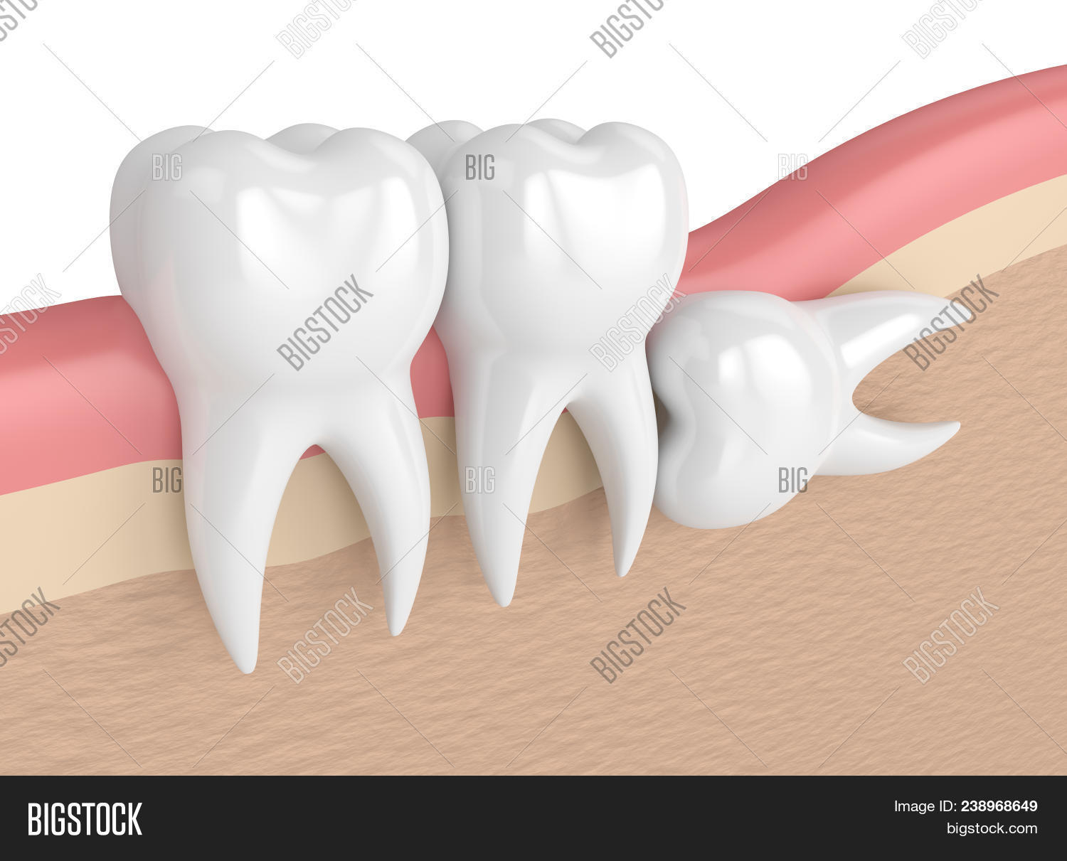 3D Render Teeth Wisdom Image & Photo (Free Trial) | Bigstock