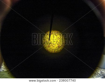 Asian Rust (phakopsora Image & Photo (Free Trial) | Bigstock