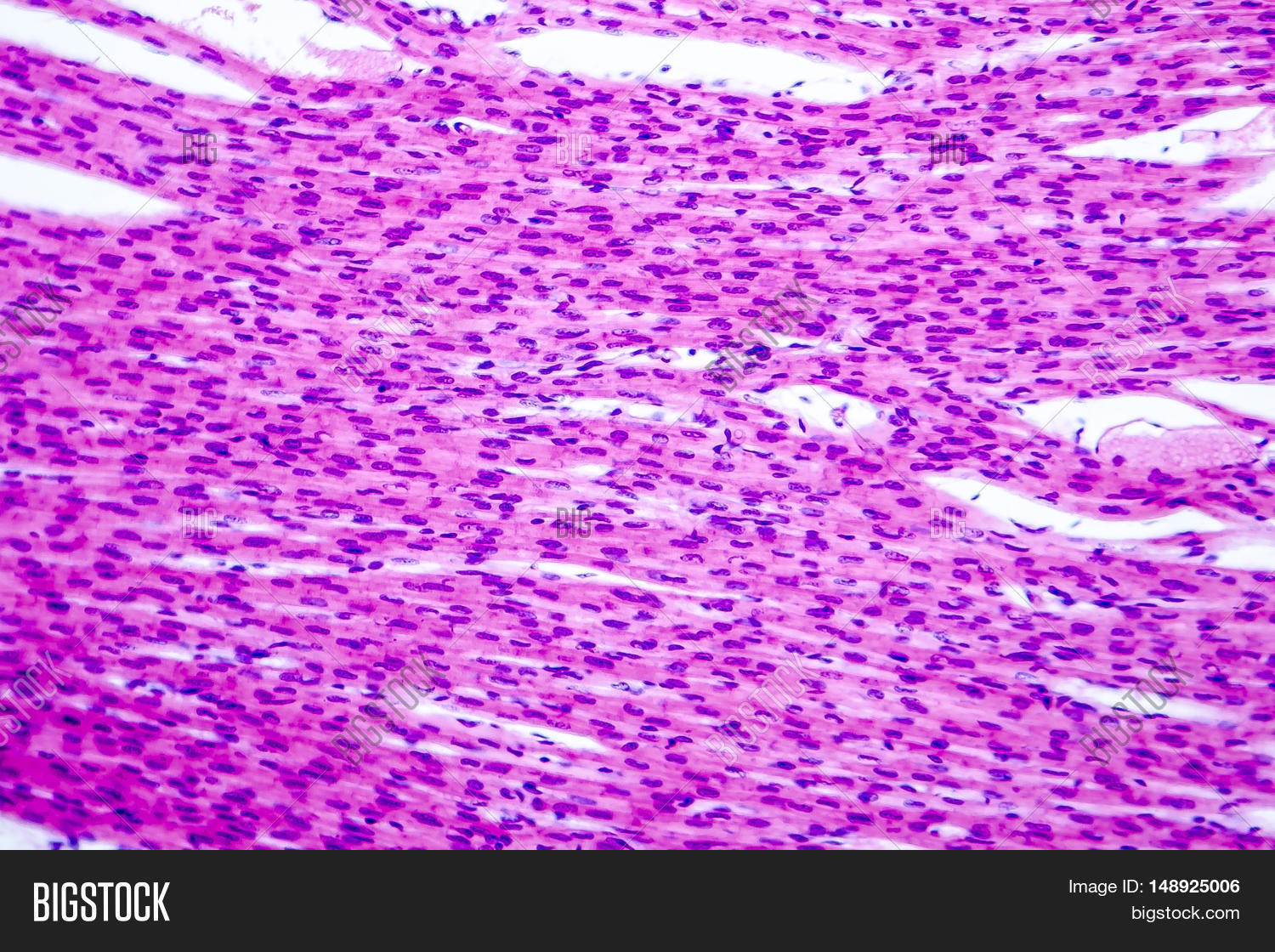 Human Heart Cells Under Microscope Micropedia Cardiac Muscle Tissue