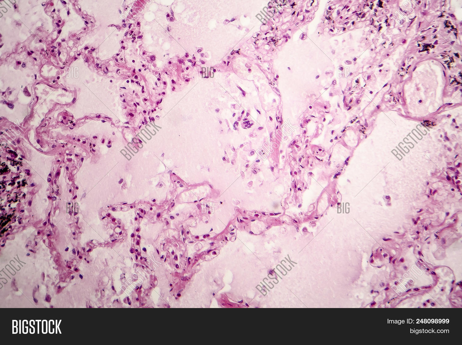 Histopathology Acute Image & Photo (Free Trial) | Bigstock