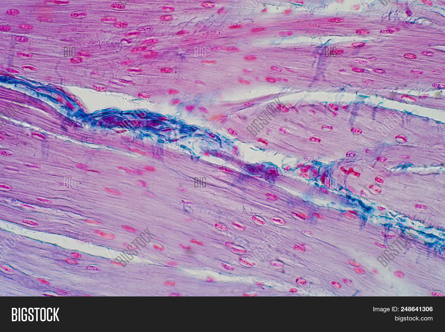 Histology Human Smooth Image & Photo (Free Trial) | Bigstock