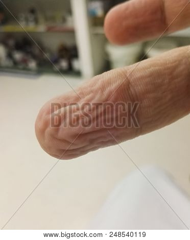 Anatomy Body: Finger Image & Photo (Free Trial) | Bigstock