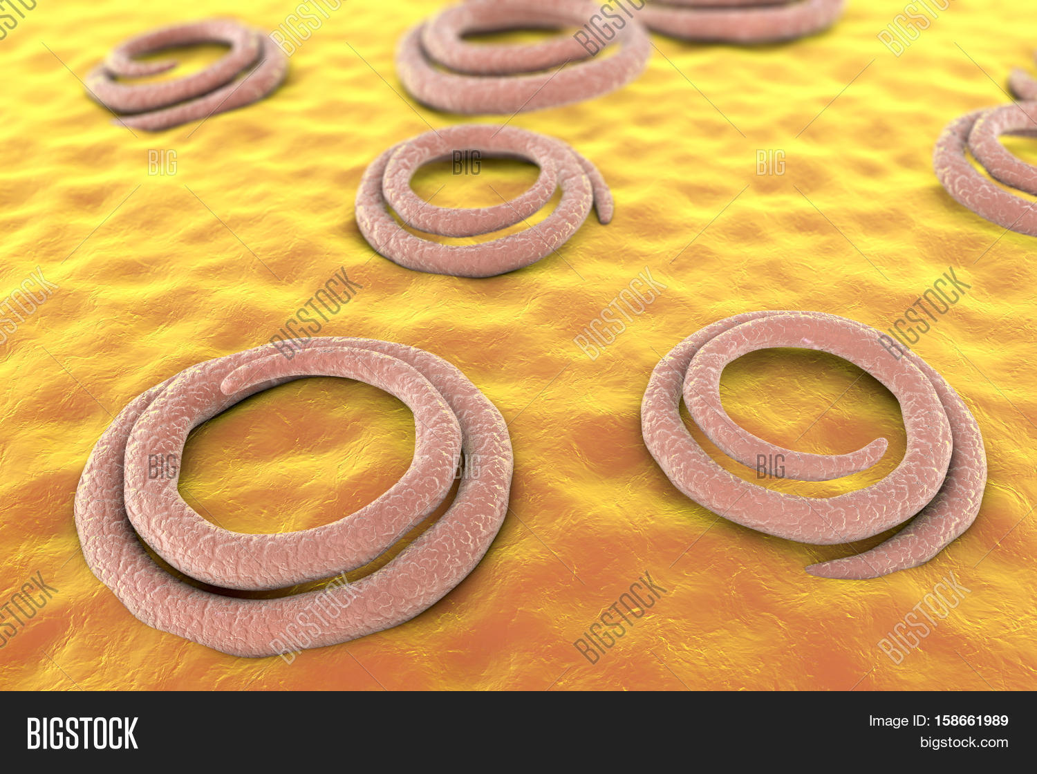 Roundworms Trichina Image & Photo (Free Trial) | Bigstock