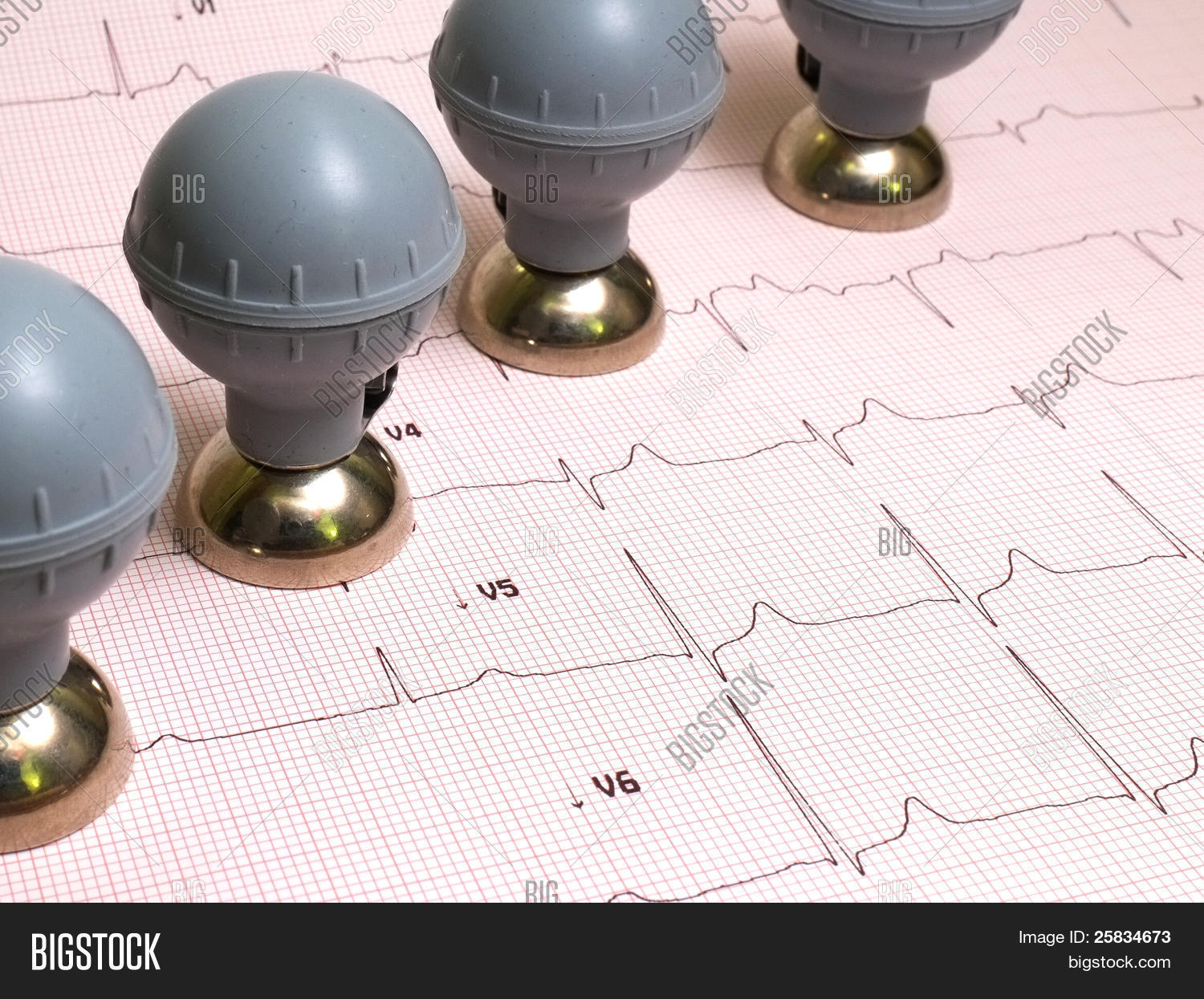 ECG Balloon Chest Image & Photo (Free Trial) | Bigstock