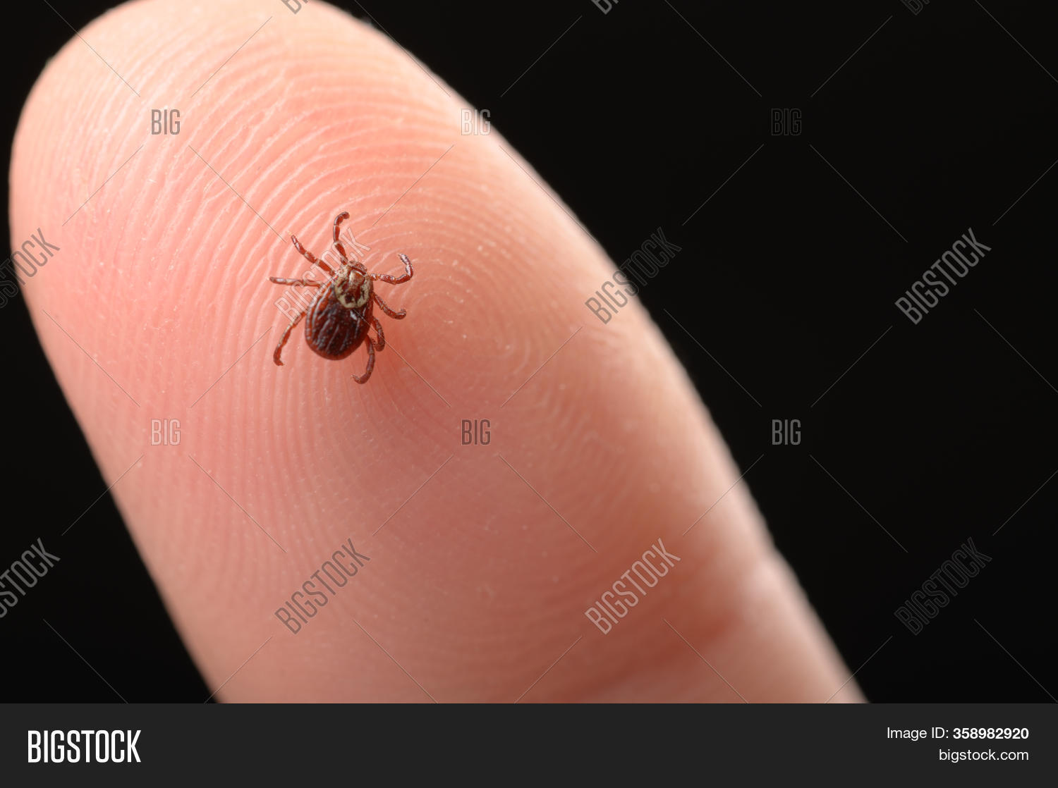 Mite On Person's Image & Photo (Free Trial) | Bigstock