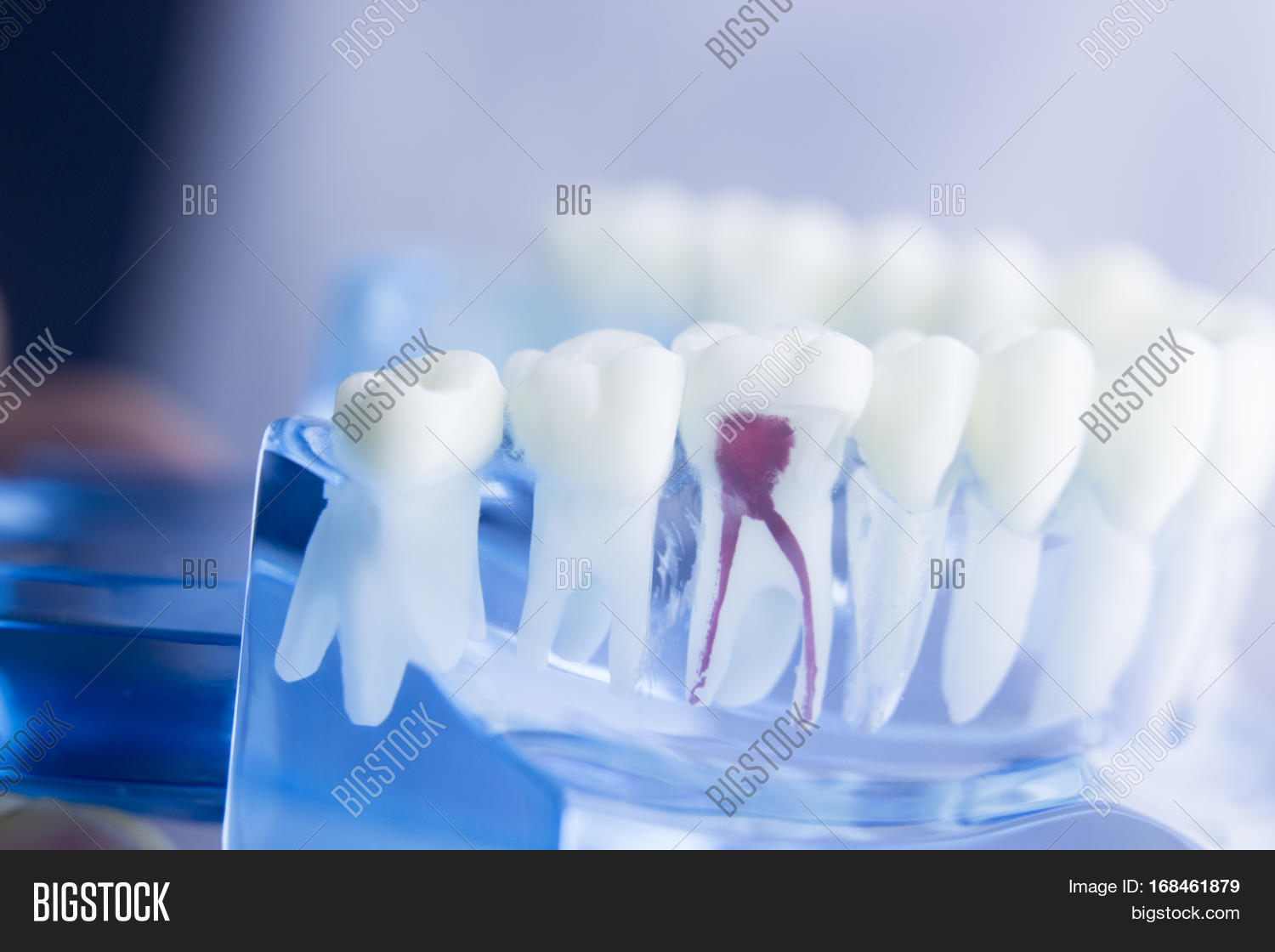 Dental Tooth Root Image & Photo (Free Trial) | Bigstock