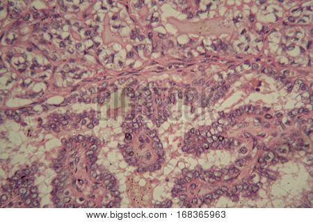 Human Thyroid Gland Image & Photo (Free Trial) | Bigstock