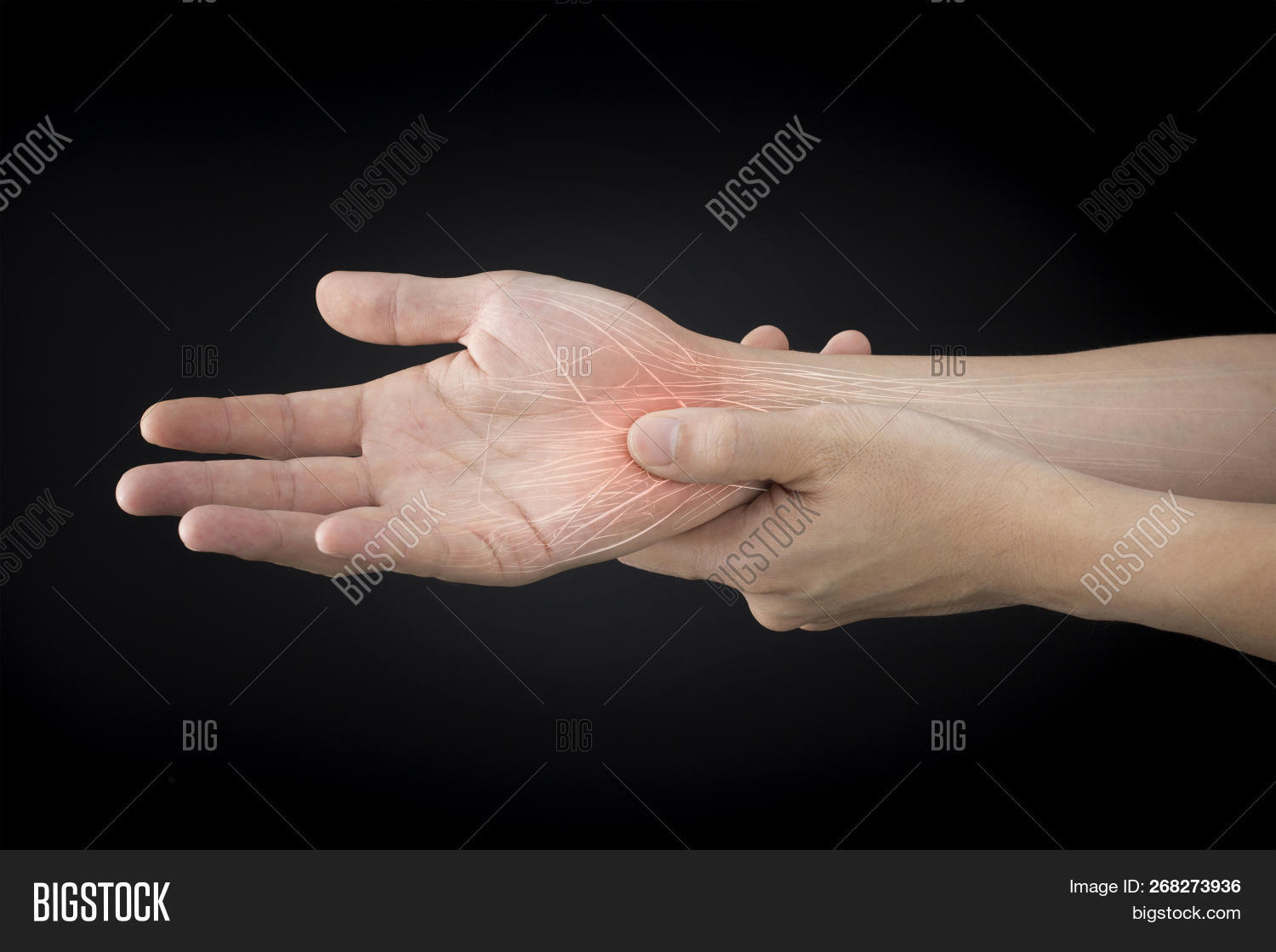 Wrist Muscle Injury Image & Photo (Free Trial) | Bigstock