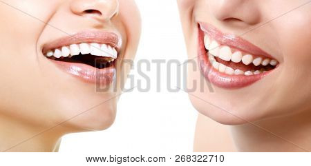 Beautiful Wide Smiles Image & Photo (Free Trial) | Bigstock