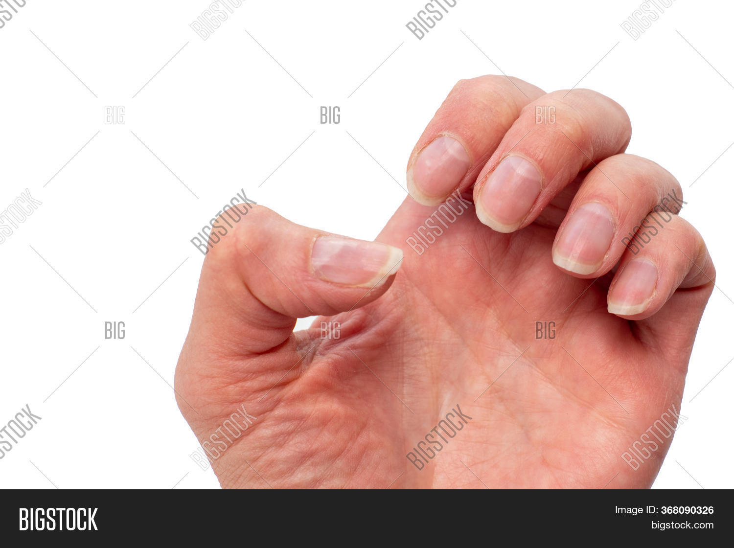 Close- Brittle Nails, Image & Photo (Free Trial) | Bigstock