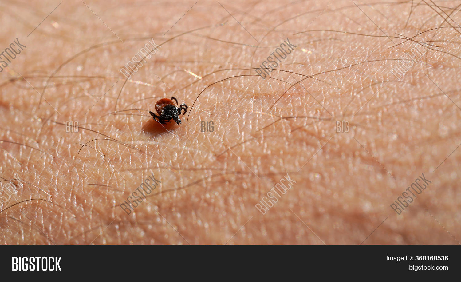 Small Tick Ixodes Image & Photo (Free Trial) | Bigstock