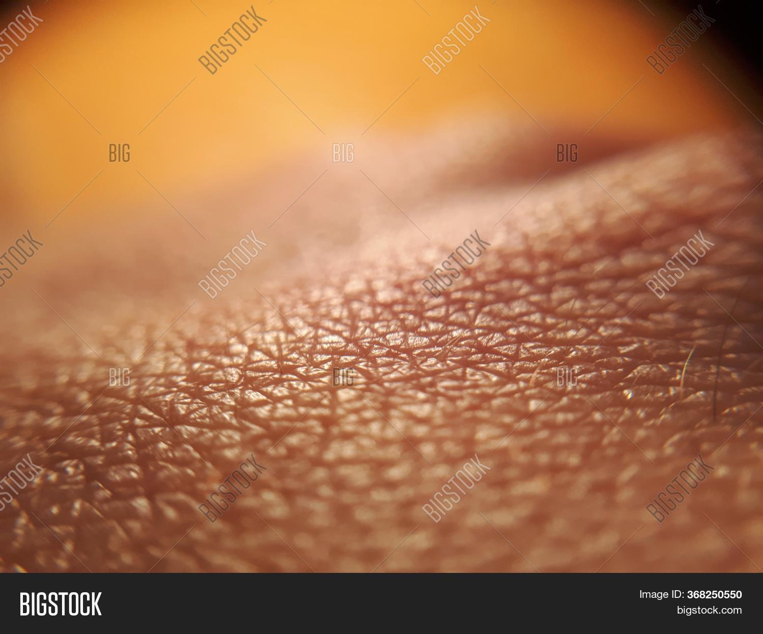 Closeup Skin Human Image & Photo (Free Trial) | Bigstock