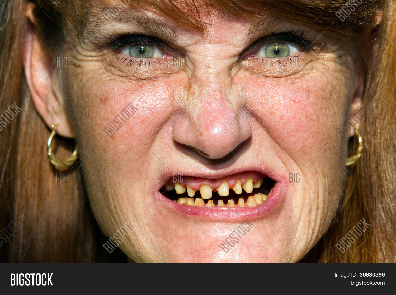 Scary Face Bad Teeth Image & Photo (Free Trial) | Bigstock