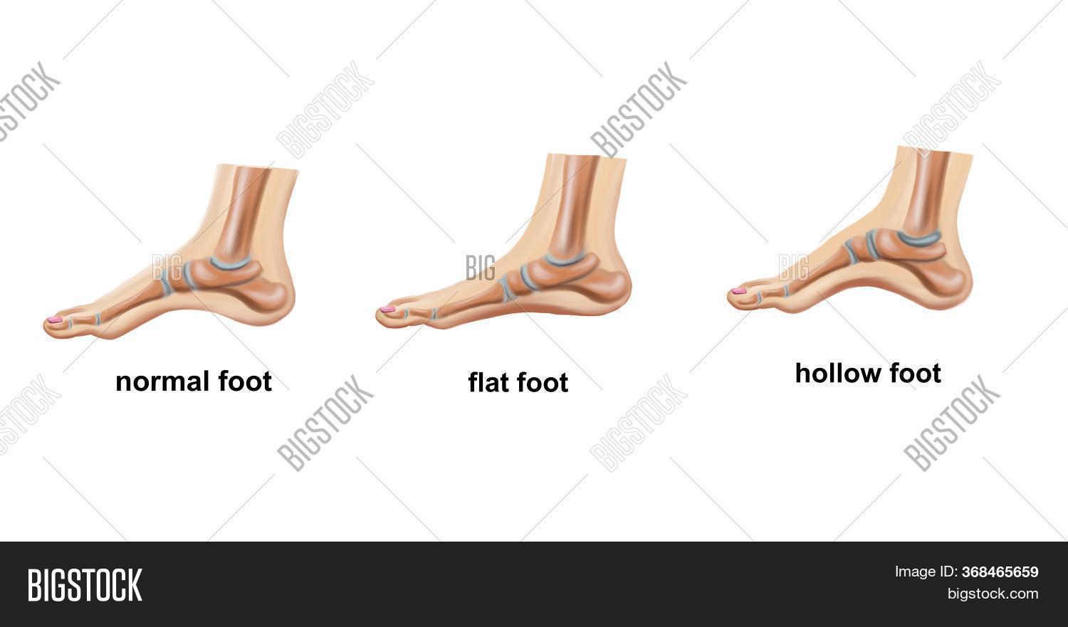 Illustration Normal Image & Photo (Free Trial) | Bigstock