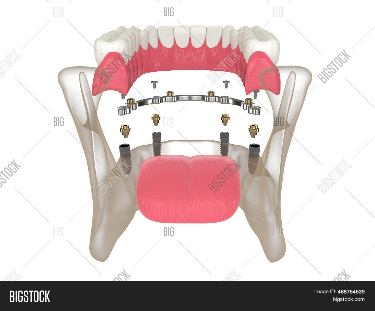 3d Render Bar Retained Image & Photo (Free Trial) | Bigstock