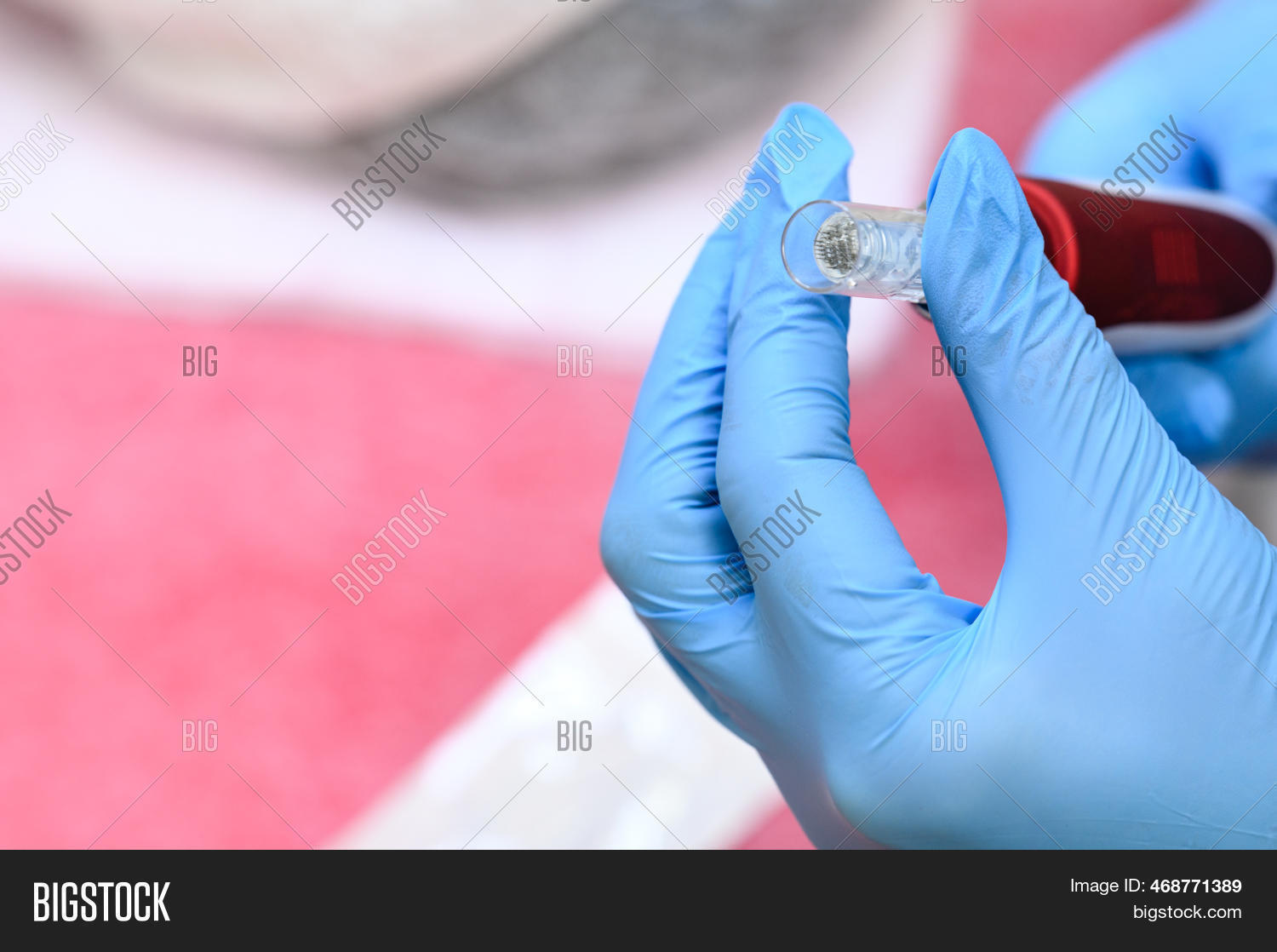 Preparation Dermapen Image & Photo (Free Trial) | Bigstock