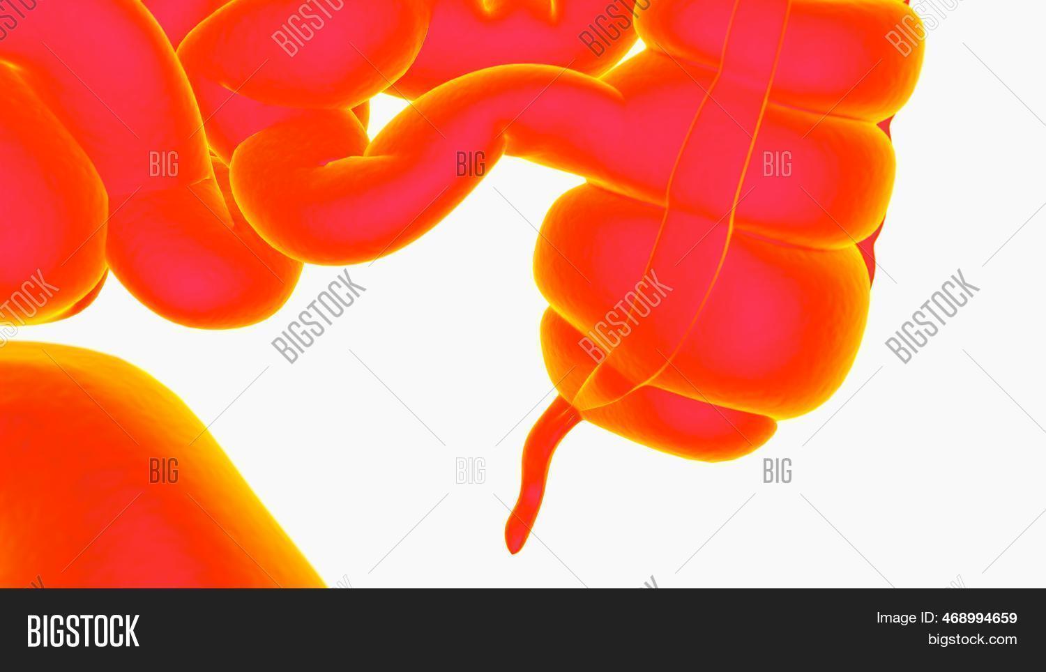Large Intestine Image & Photo (Free Trial) | Bigstock