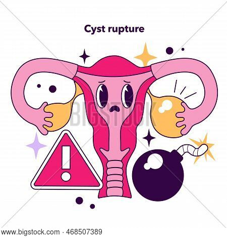 Cyst Rupture Vector & Photo (Free Trial) | Bigstock