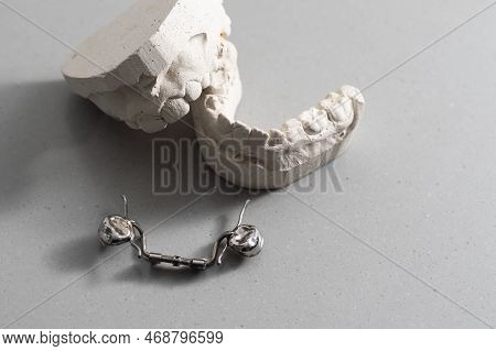 Plaster Models Dental Image & Photo (Free Trial) | Bigstock