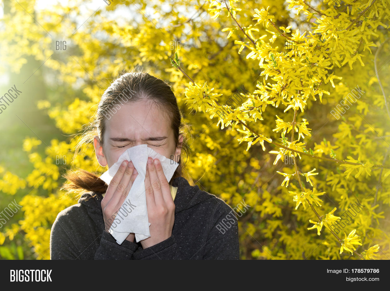 Girl Allergic Reaction Image & Photo (Free Trial) | Bigstock