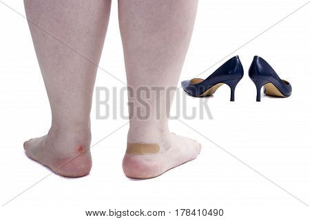 Female Legs Callus On Image & Photo (Free Trial) | Bigstock