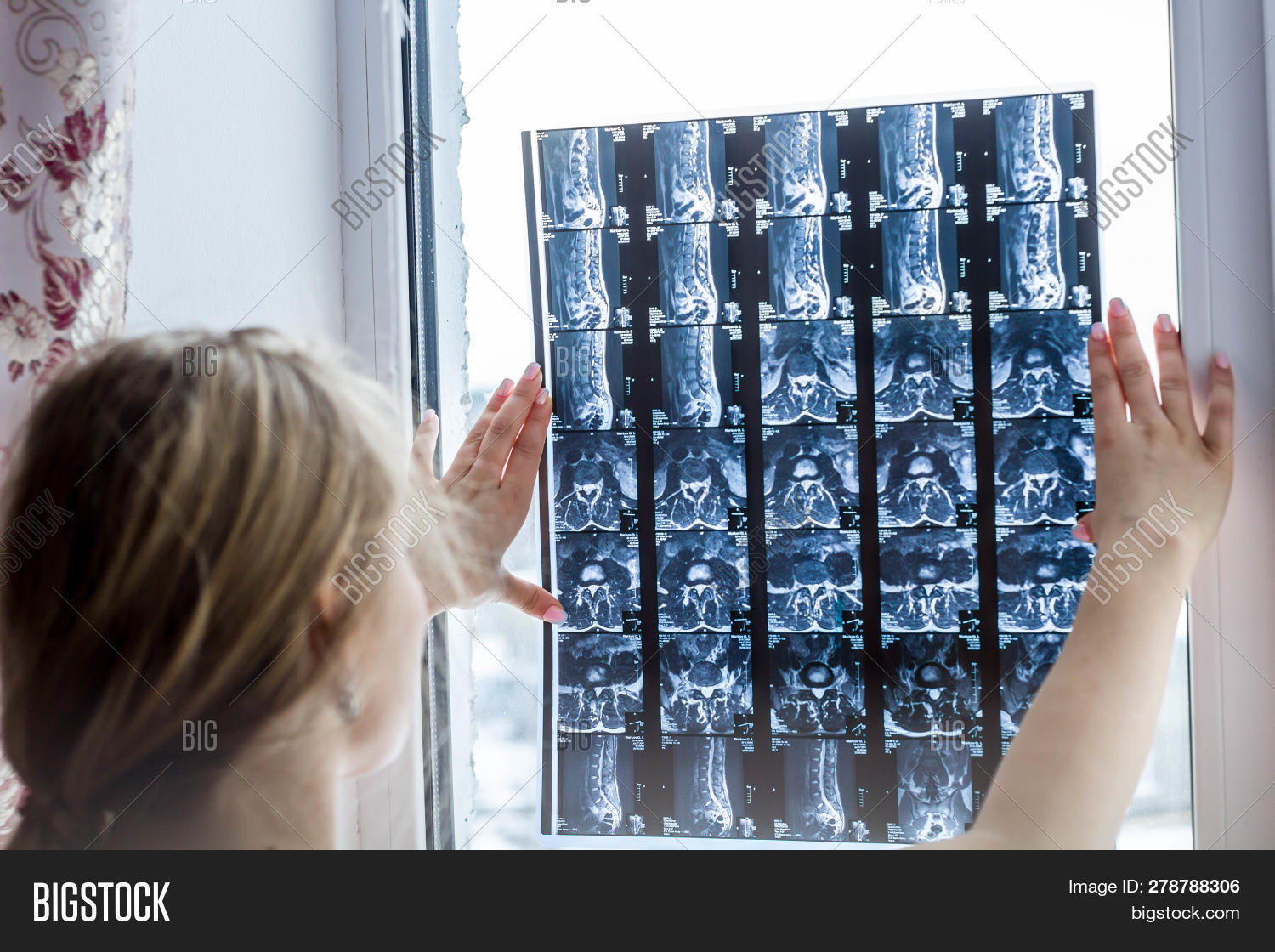 Mri Back Vertebral Image & Photo (Free Trial) | Bigstock