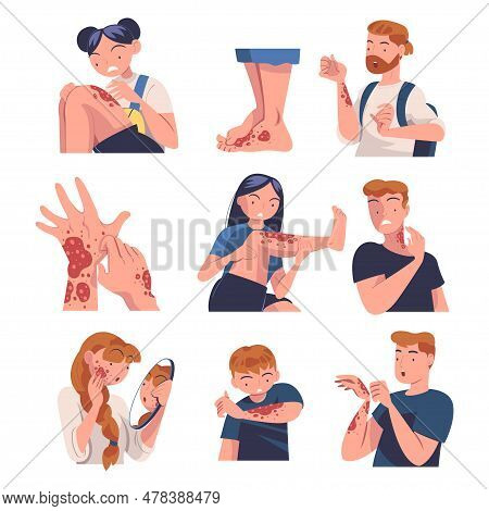 Skin Problems People Vector & Photo (Free Trial) | Bigstock