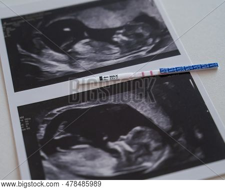 Positive Pregnancy Image & Photo (Free Trial) | Bigstock
