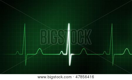 Green Graphic Ekg Image & Photo (Free Trial) | Bigstock