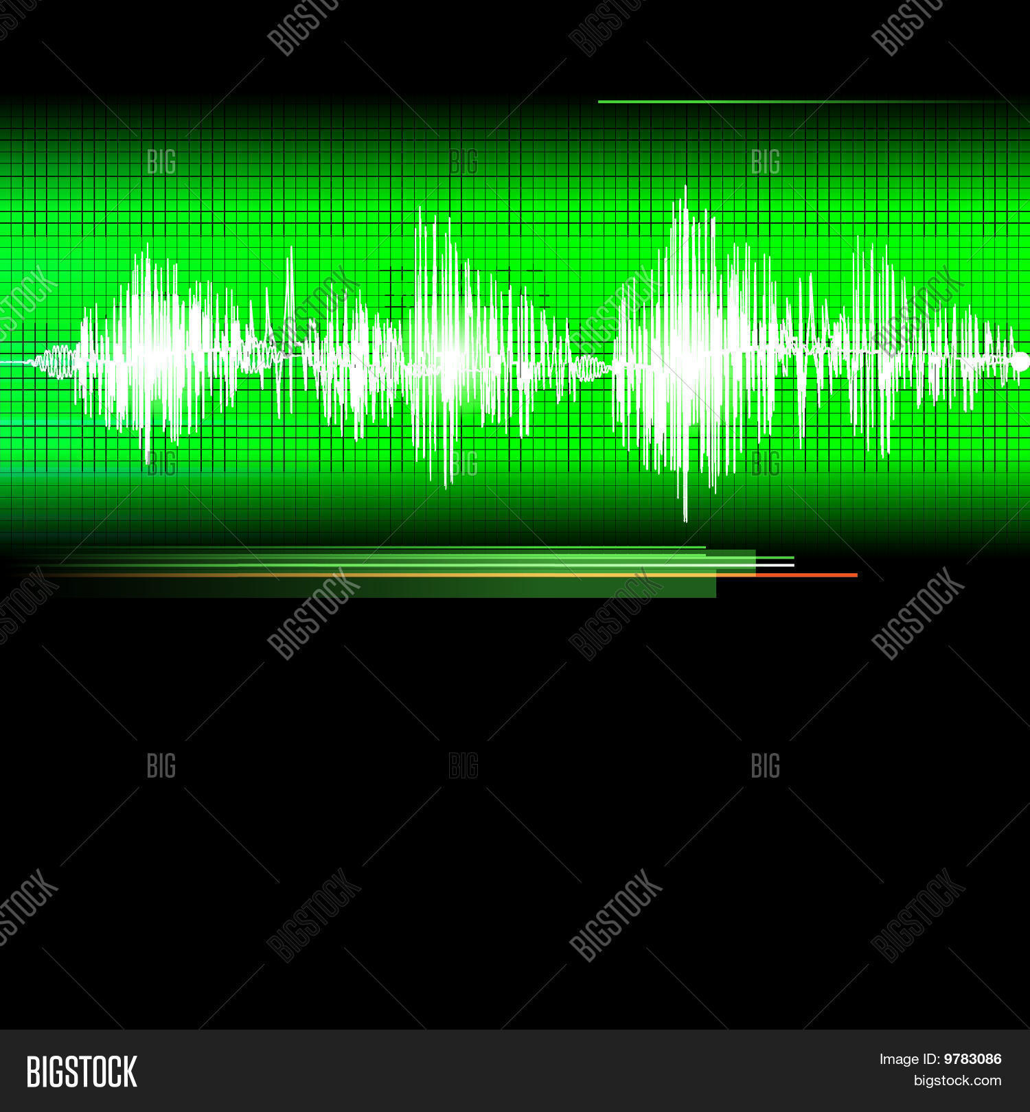 Ecg Electrocardiogram Vector & Photo (Free Trial) | Bigstock