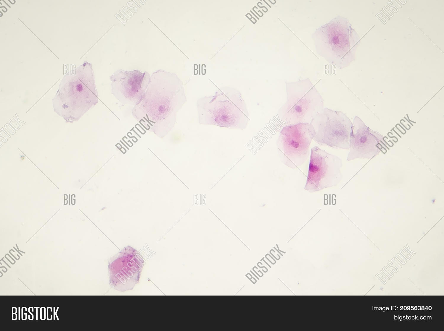 Human Buccal Smear Image & Photo (Free Trial) | Bigstock