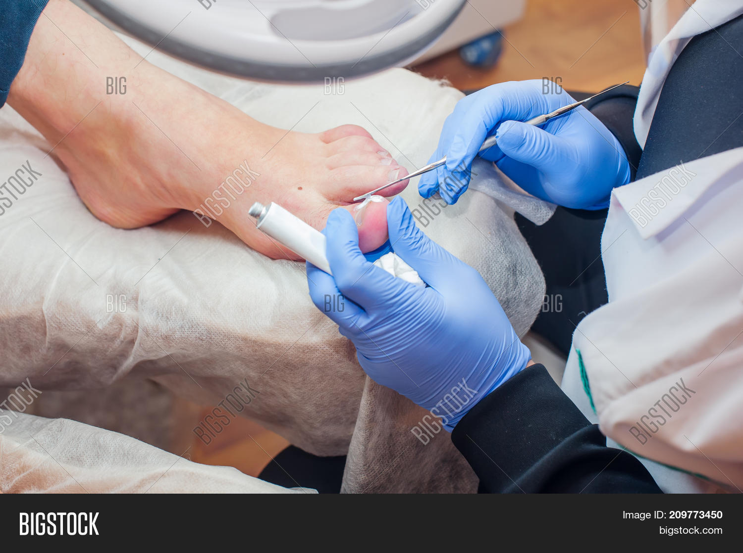 Podology Treatment. Image & Photo (Free Trial) | Bigstock