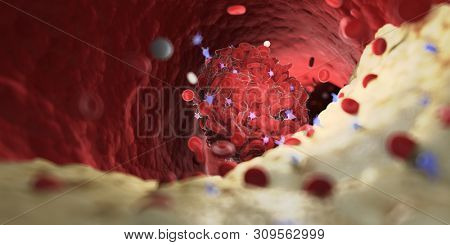 3d Rendered Medically Image & Photo (Free Trial) | Bigstock