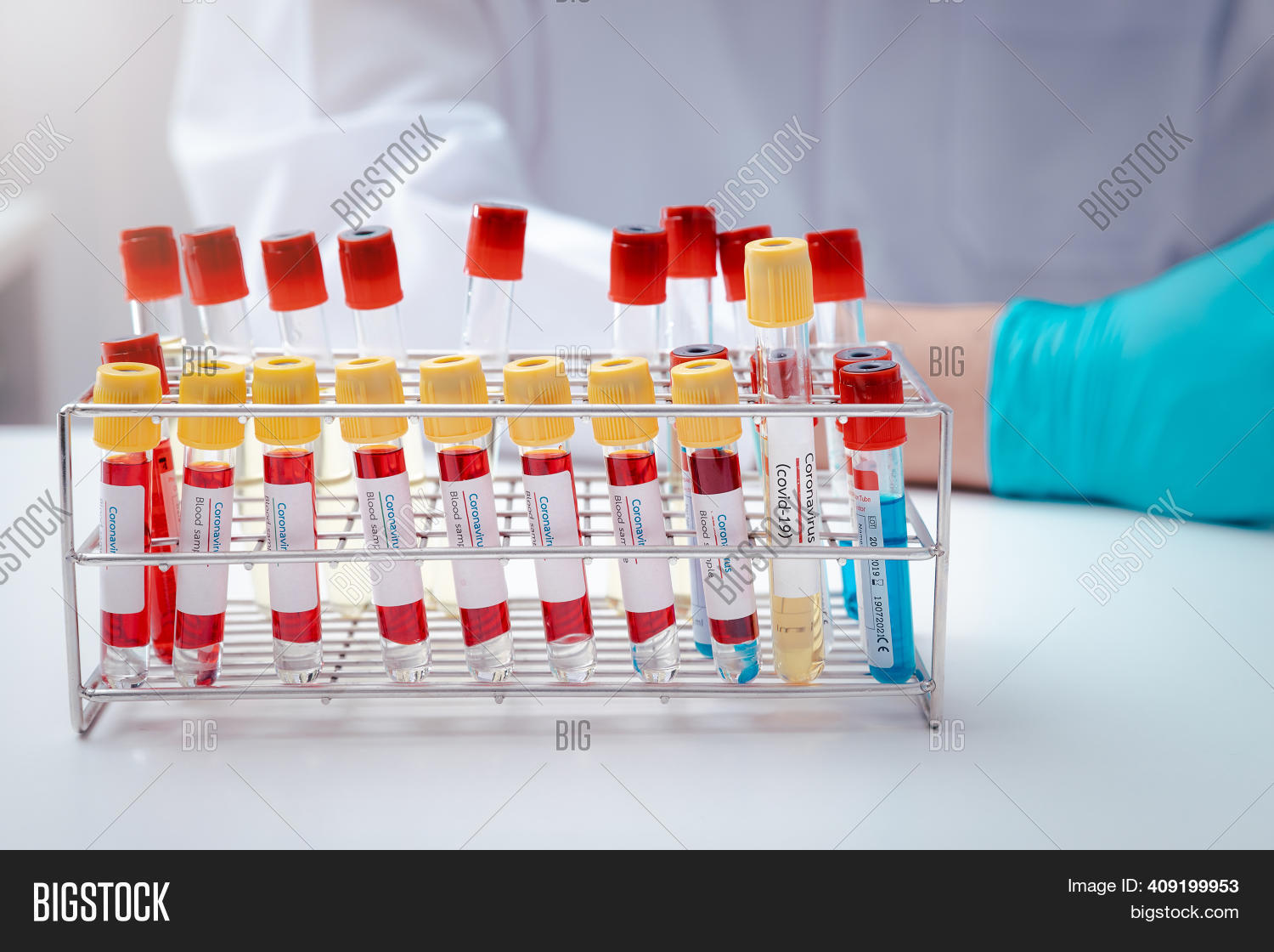 Blood Samples Plasma Image & Photo (Free Trial) | Bigstock
