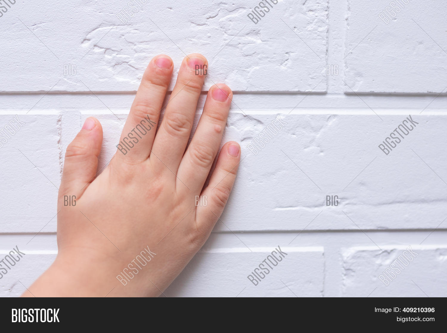 Common Wart Verruca Image & Photo (Free Trial) | Bigstock