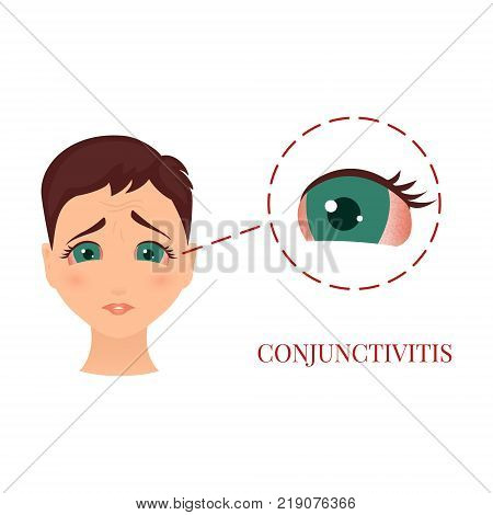 Woman Conjunctivitis Vector & Photo (Free Trial) | Bigstock