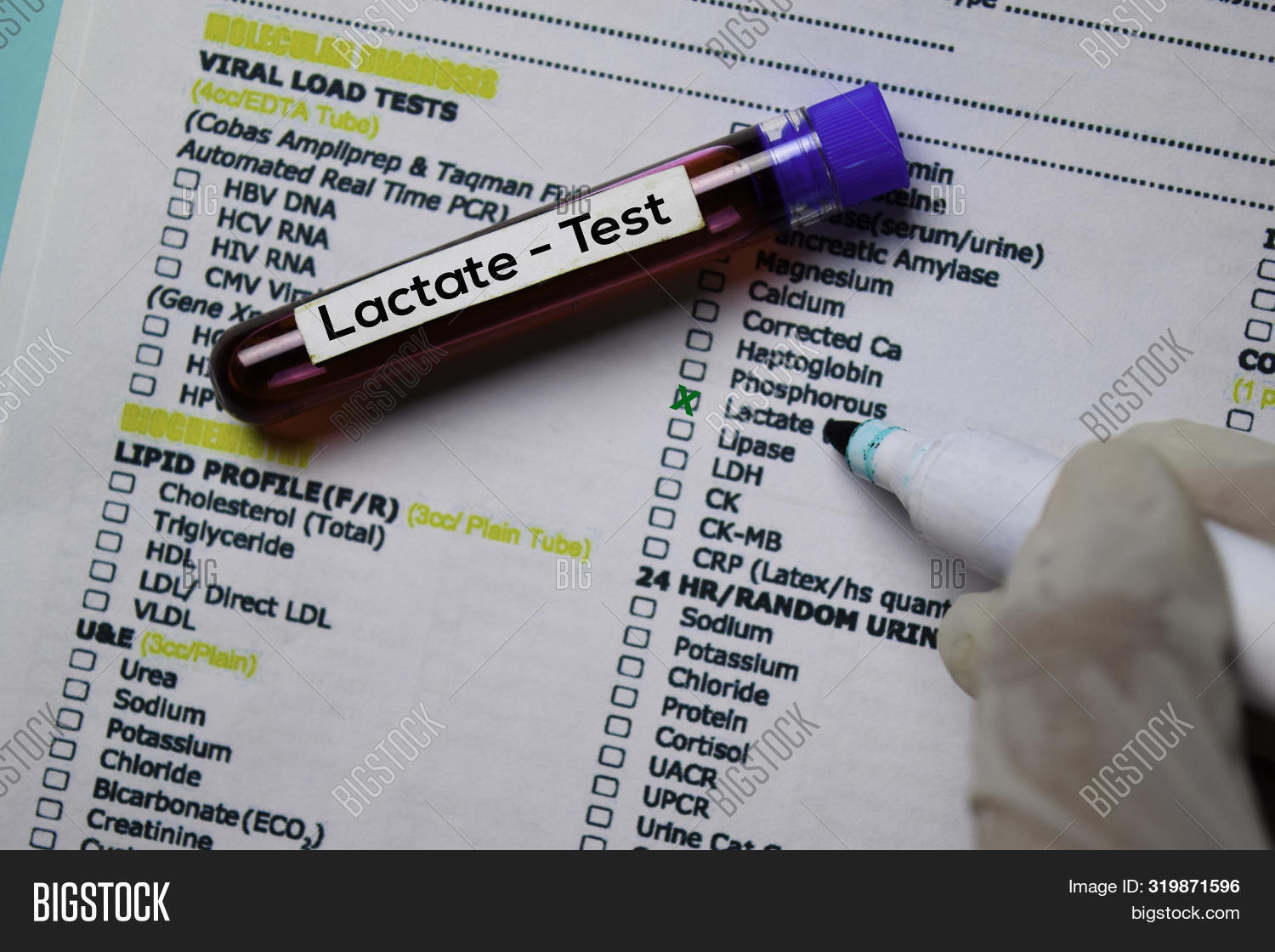 Lactate - Test Blood Image & Photo (Free Trial) | Bigstock