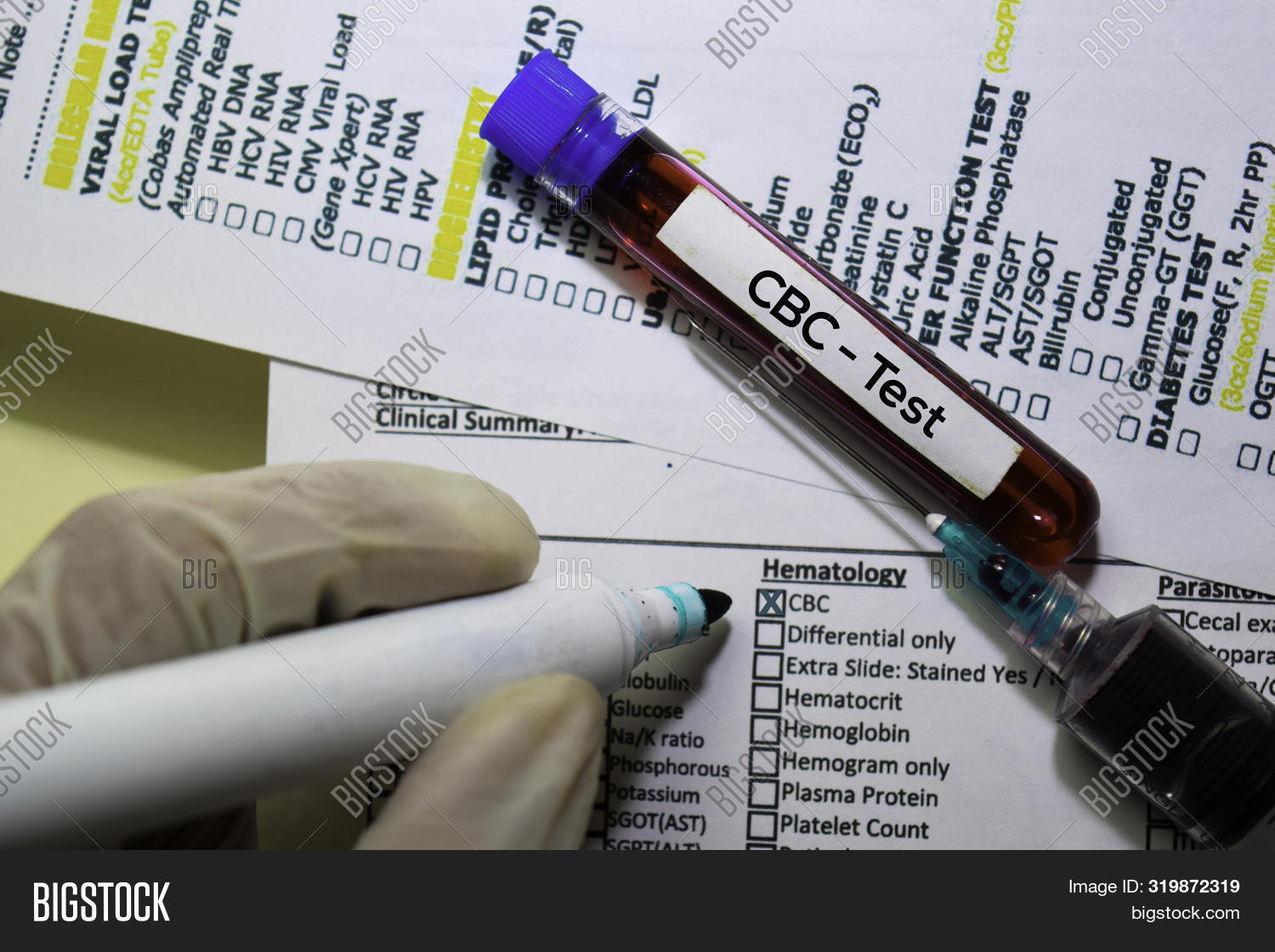 Cbc - Test Blood Image & Photo (Free Trial) | Bigstock
