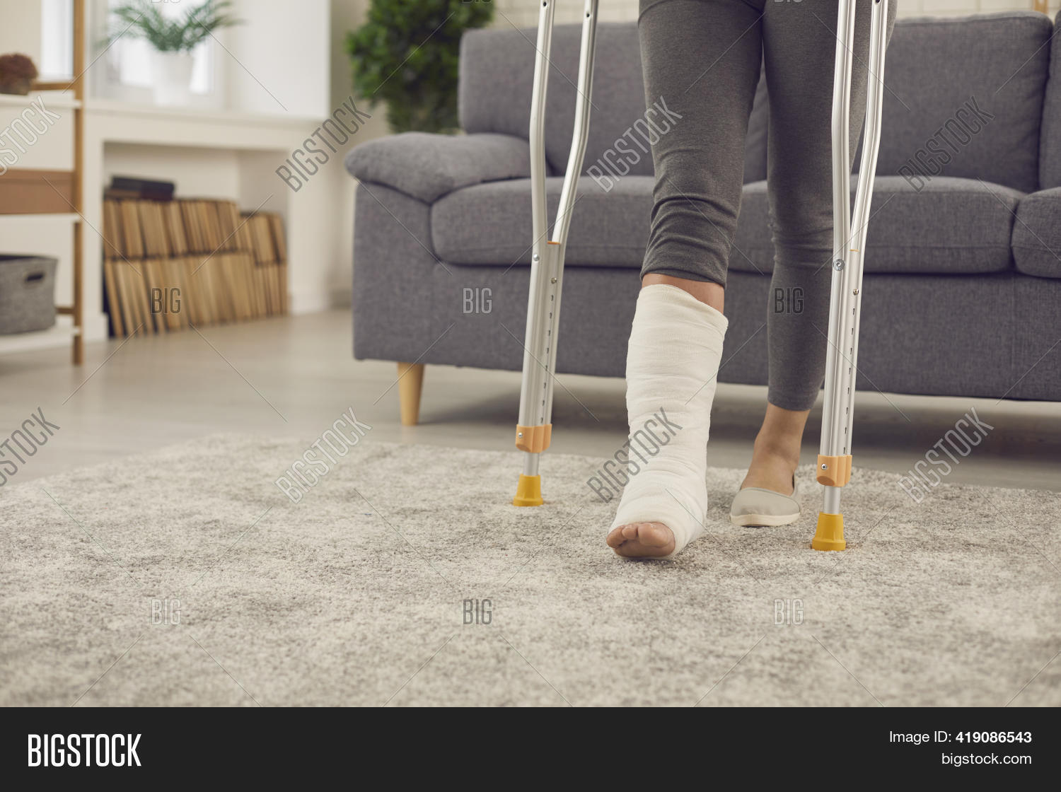 Patient Broken Leg Image & Photo (Free Trial) | Bigstock