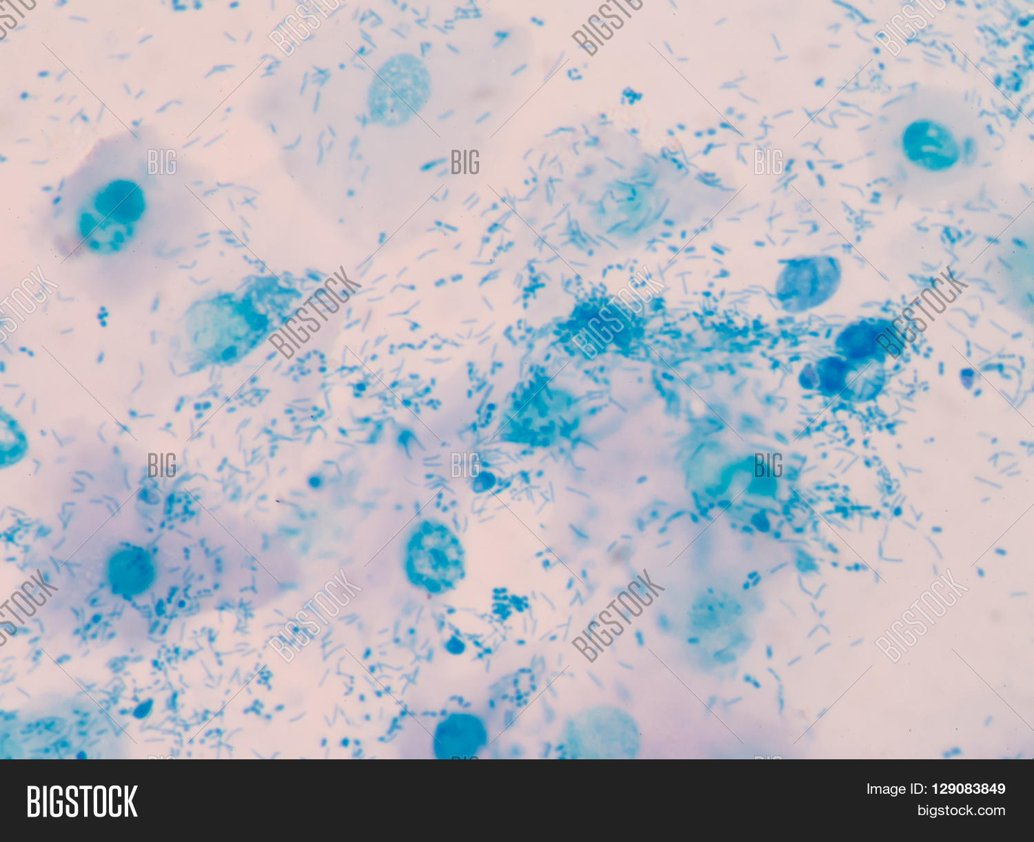 Background Blue Image & Photo (Free Trial) | Bigstock