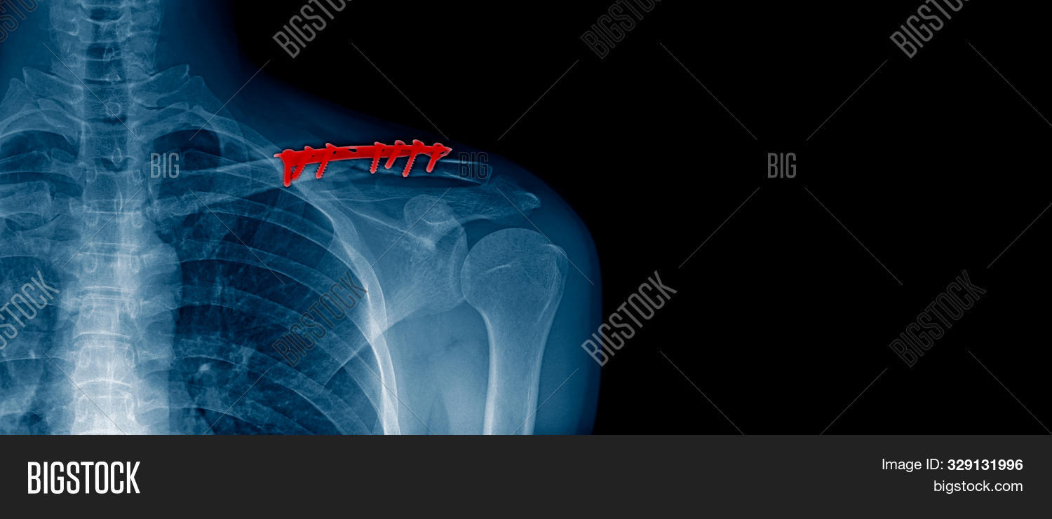 X-ray Image Banner Image & Photo (Free Trial) | Bigstock