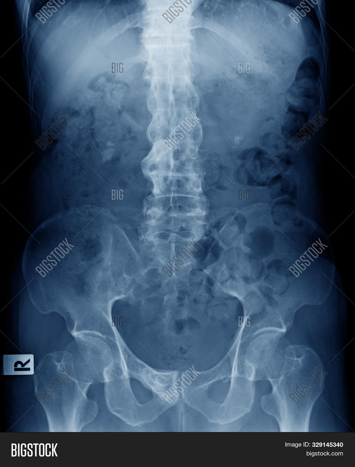 X-ray Image Old Man Image & Photo (Free Trial) | Bigstock