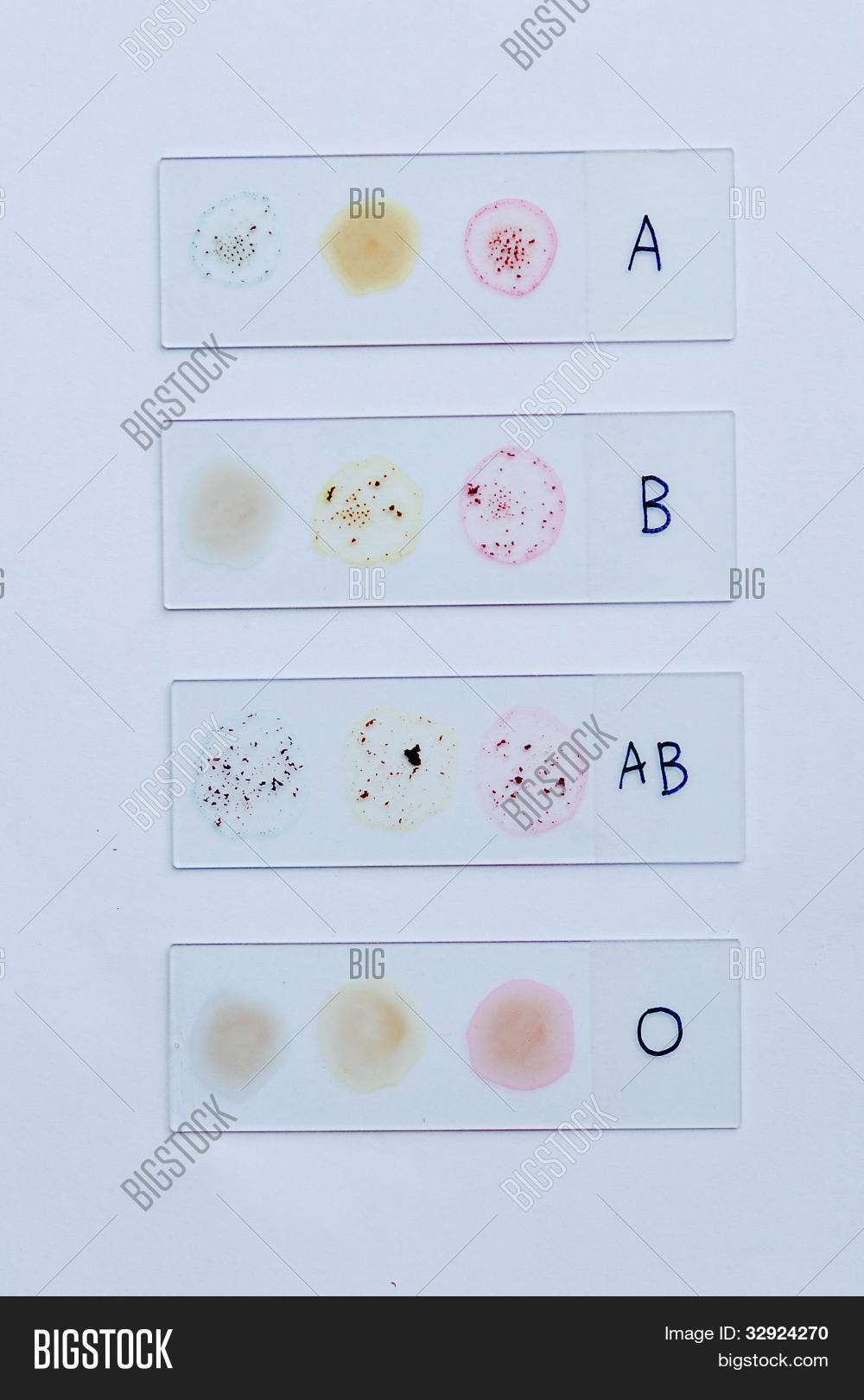 Blood Group Testing Image & Photo (Free Trial) | Bigstock