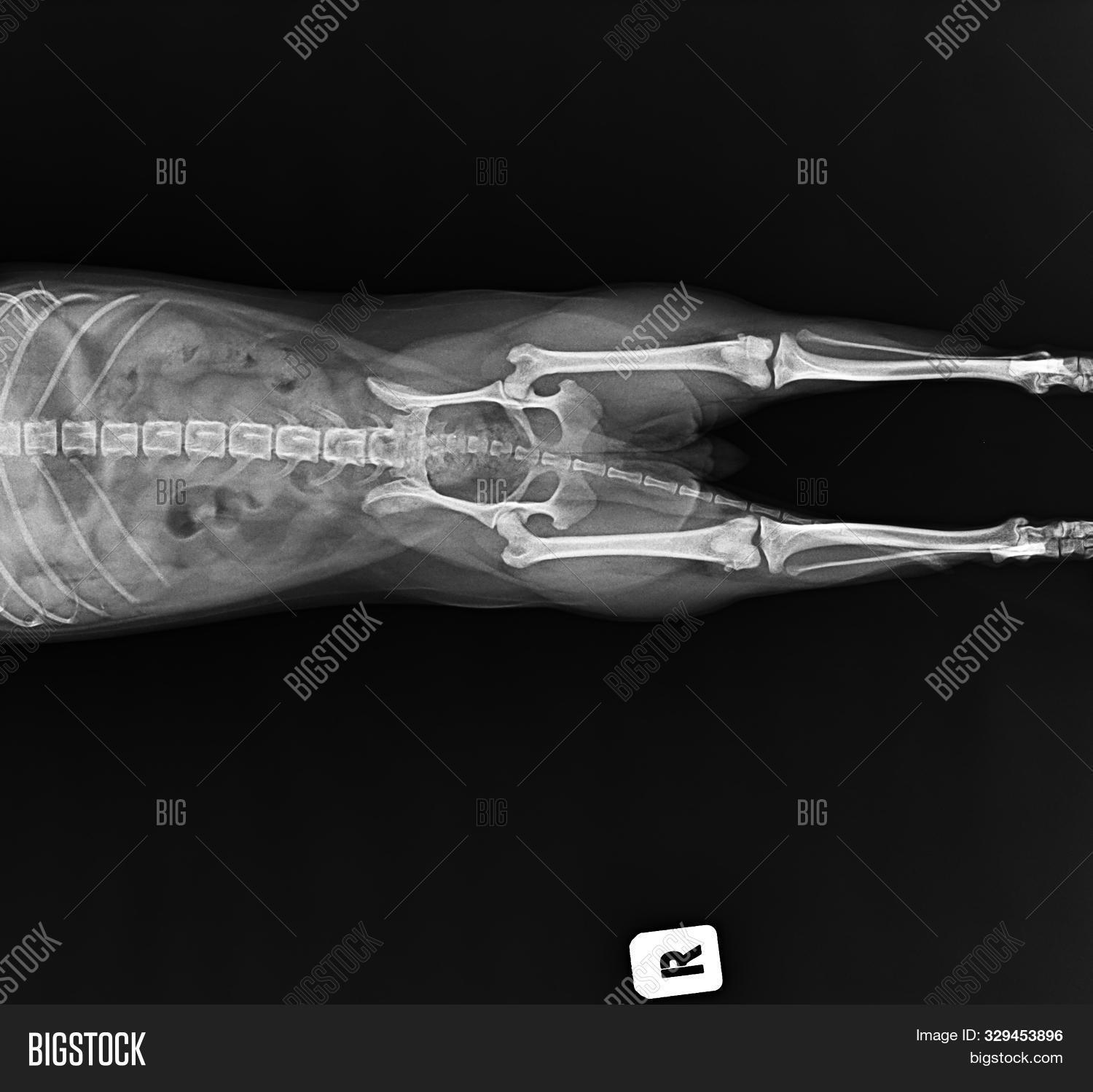 X-ray Photo Image & Photo (Free Trial) | Bigstock