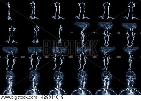 Mra Mri Image Blood Image & Photo (Free Trial) | Bigstock