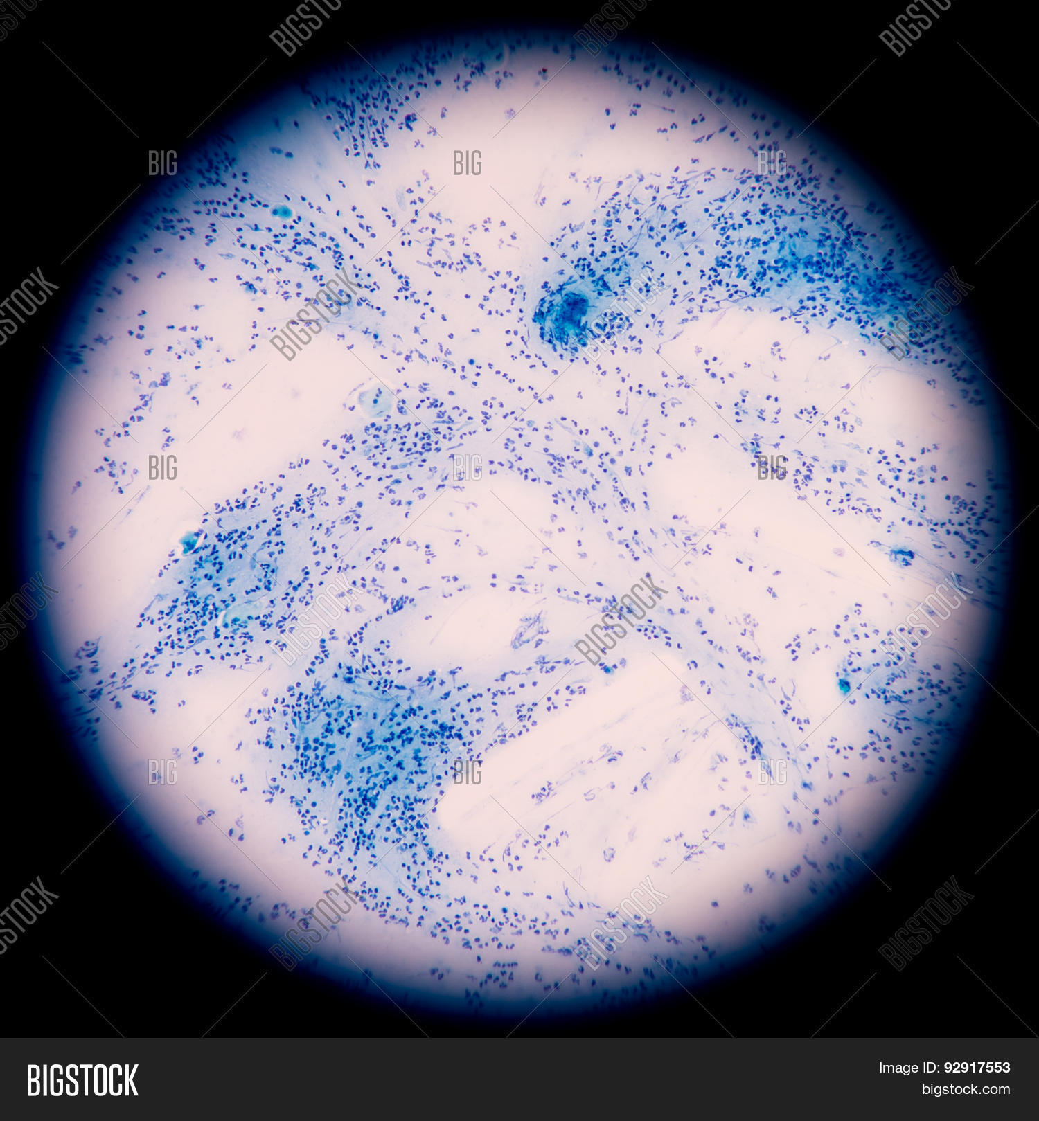 Slide Sputum Afb Image & Photo (Free Trial) | Bigstock