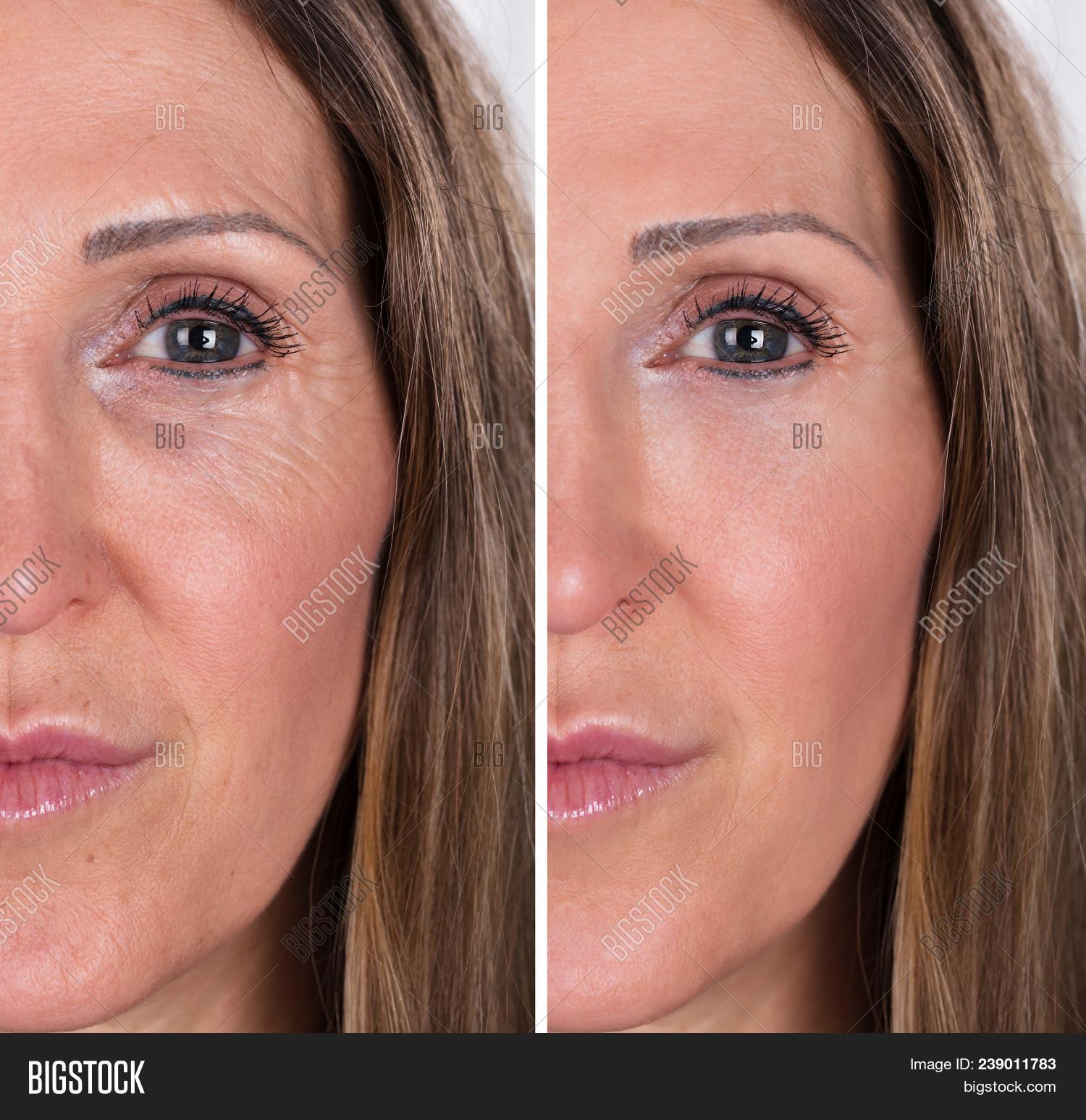 Photo Anti-aging Image & Photo (Free Trial) | Bigstock