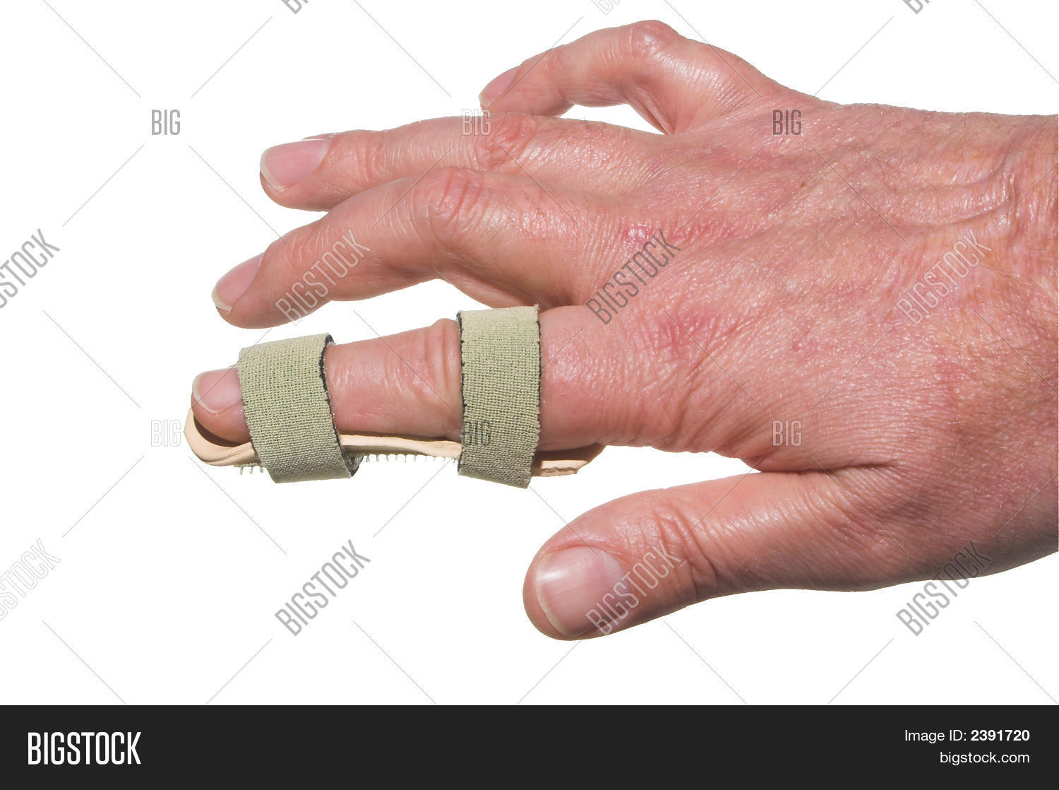 Broken Finger Image & Photo (Free Trial) | Bigstock